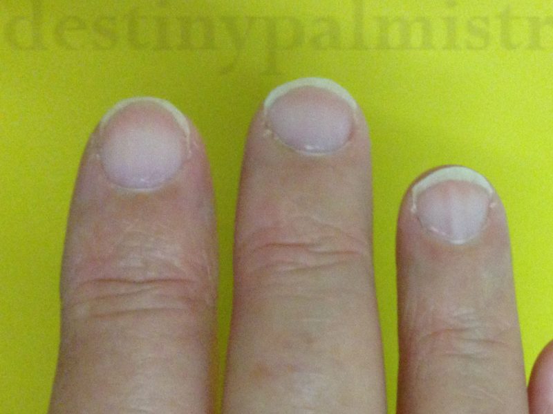 White Fingernails and Other Health Warnings - Destiny Palmistry