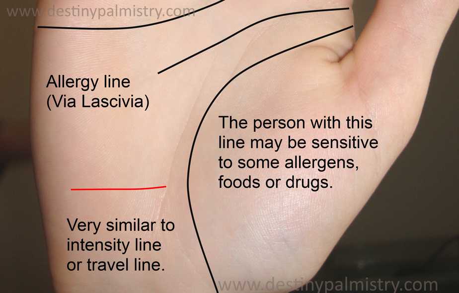 Poison Line (Poison Bar) Meaning on the Palm - Destiny Palmistry