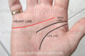 Heart Line Joins Head Line or Dips Downward - Destiny Palmistry
