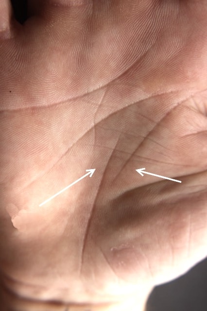 broken life line Archives - Destiny Palmistry