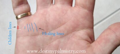 Healing Lines and Their Meaning in Palmistry - Destiny Palmistry
