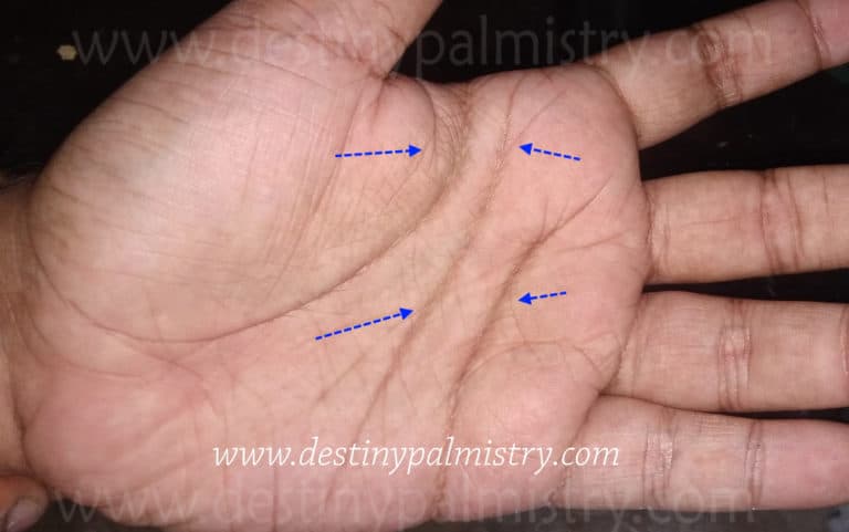 Signs of Mental Disturbance on the Palms - Destiny Palmistry