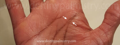 Island Mark on the Lines of the Palm - Destiny Palmistry