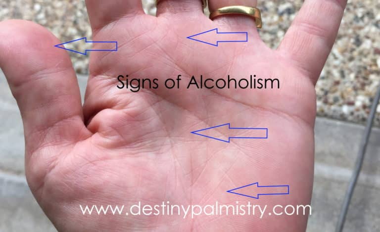Forked Head Line Meaning in Palmistry - Destiny Palmistry