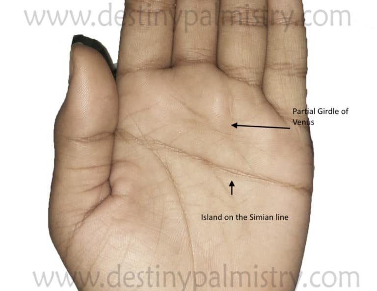 Double Simian or One Simian Line on the Palm - Destiny Palmistry