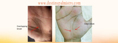 Broken Life Line Meaning in Palm Reading - Destiny Palmistry