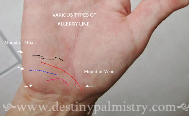 Mercury Line Health Meanings in Palmistry - Destiny Palmistry