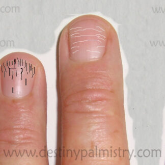 red spots on fingernails Archives - Destiny Palmistry