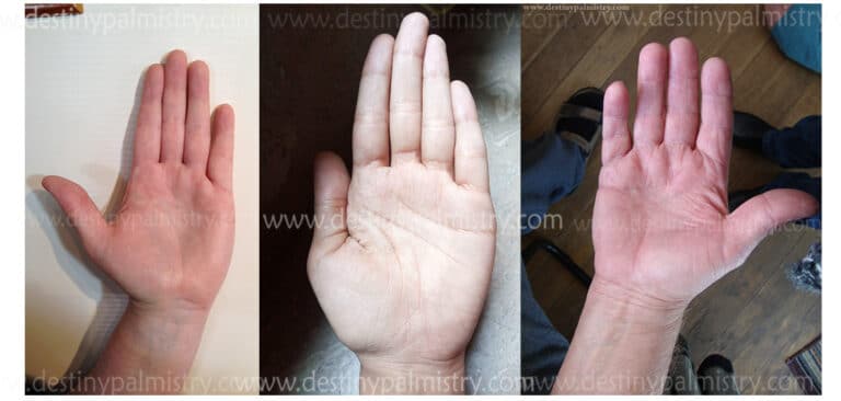 Colour of Your Hands Meaning in Palmistry? - Destiny Palmistry