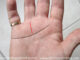 Sun Line (Apollo line) Palmistry Survey for Adults - Destiny Palmistry